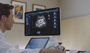 ΕΝΑΣ ΜΗ ΕΠΕΜΒΑΤΙΚΟΣ ΔΕΙΚΤΗΣ ΠΡΟΒΛΕΨΗΣ ΤΟΥ ΚΙΝΔΥΝΟΥ ΡΗΞΗΣ ΤΗΣ ...